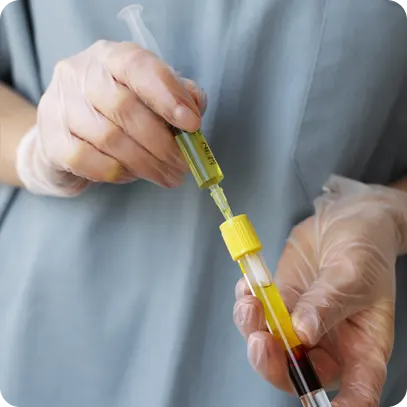 ¿Qué es un tratamiento intravenoso? | Vitae Health